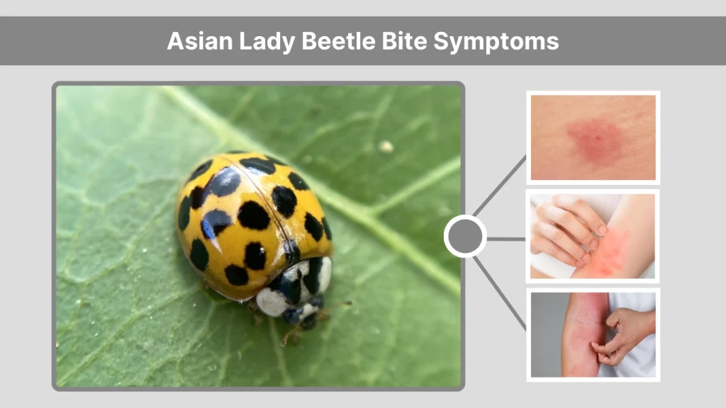 Asian Lady Beetle Bite: Symptoms, Treatment, and Prevention