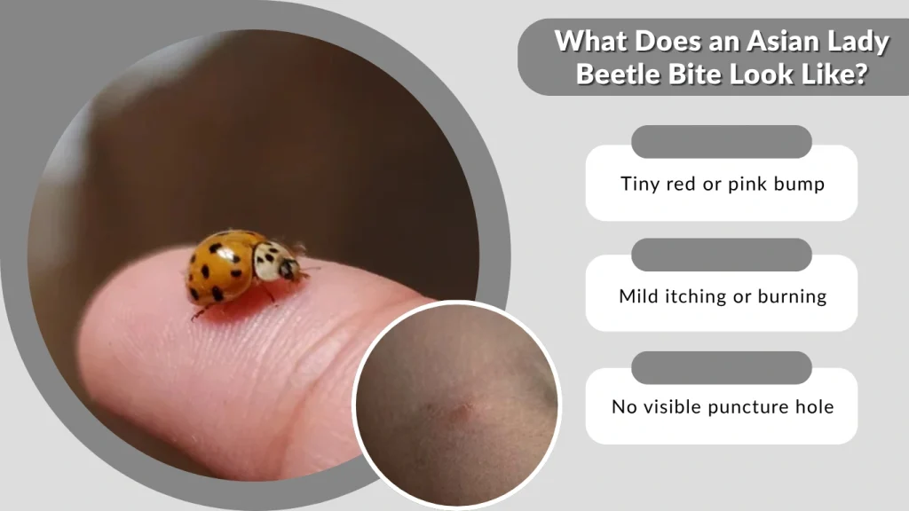 Asian Lady Beetle Bite: Symptoms, Treatment, and Prevention