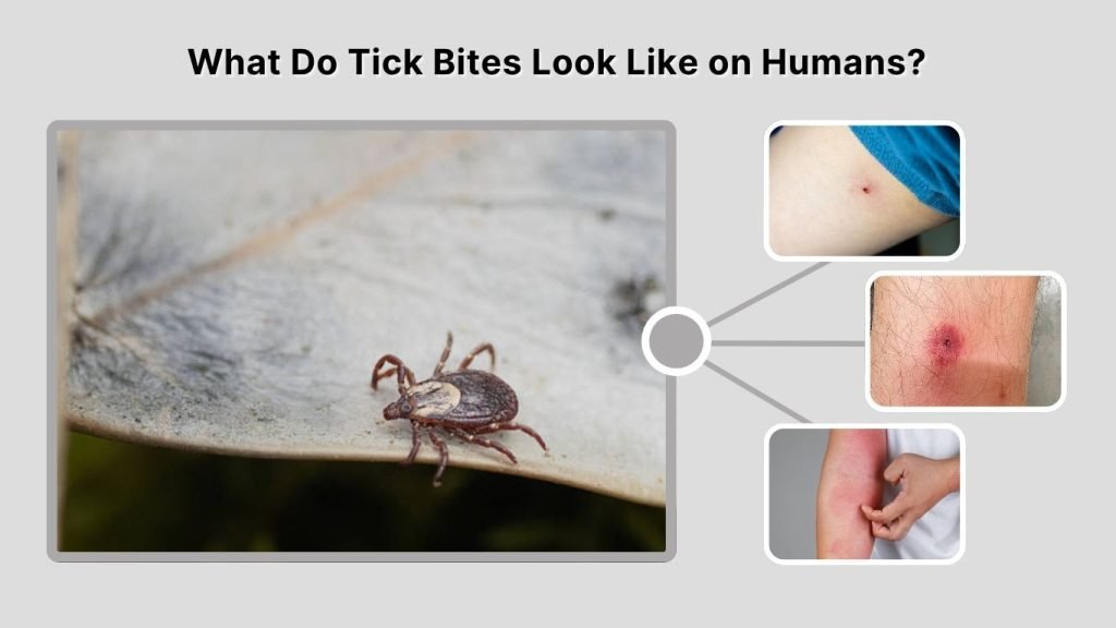 Tick Bites on Humans: Symptoms, Risks, and Treatment