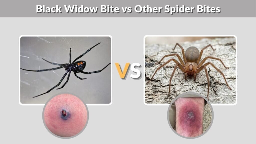 Black Widow Spider Bite Stages: Timeline, Symptoms & Care